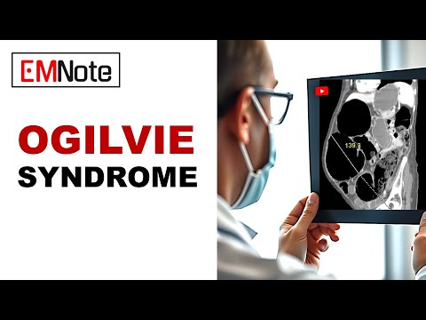 Ogilvie Syndrome (Acute Colonic Pseudoobstruction) - YouTube