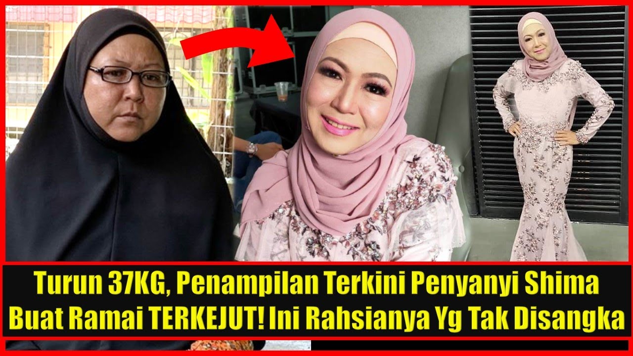 Turun 37KG, Penampilan Terkini Penyanyi Shima Buat Ramai TERKEJUT! Ini ...