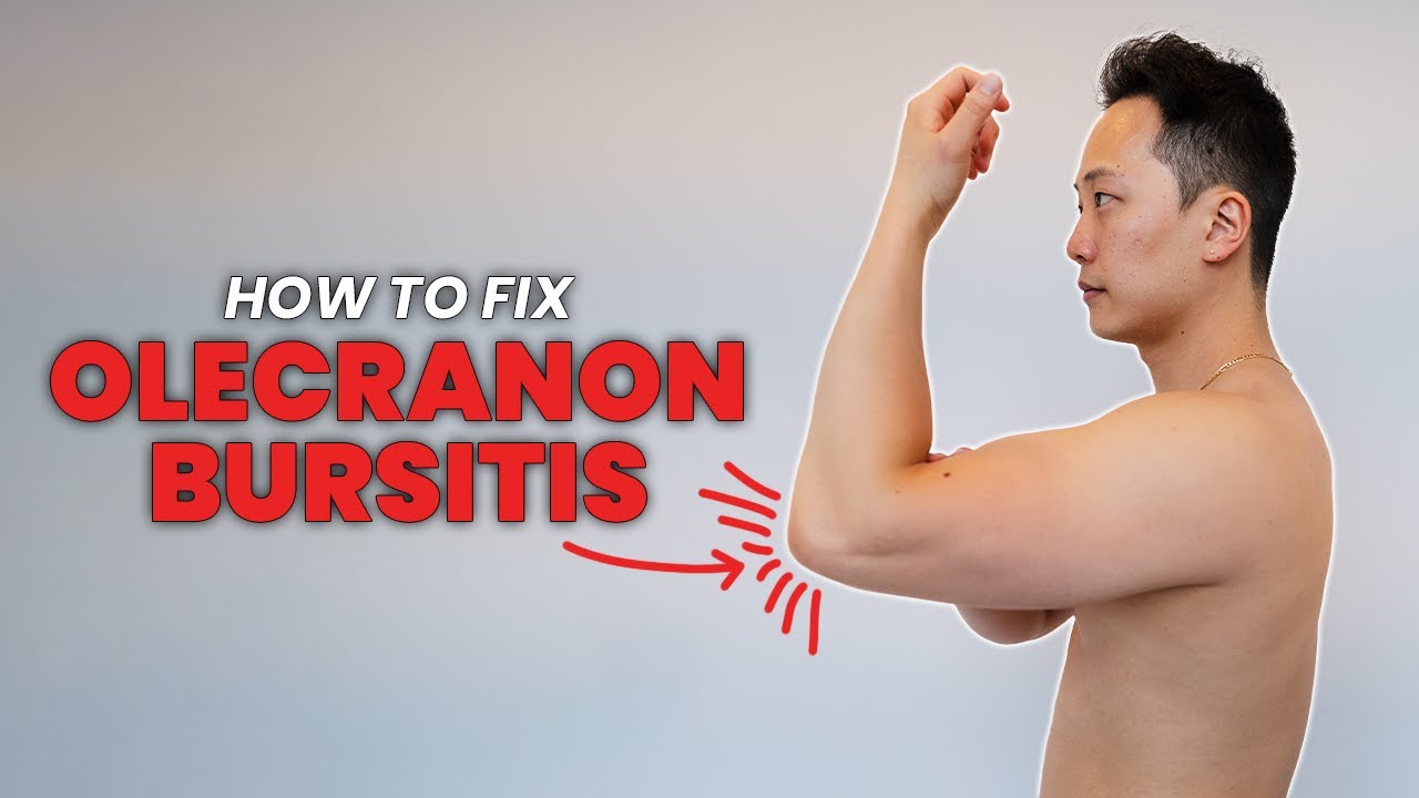 How to do exercises for Olecranon Bursitis - One cause of elbow pain in ...
