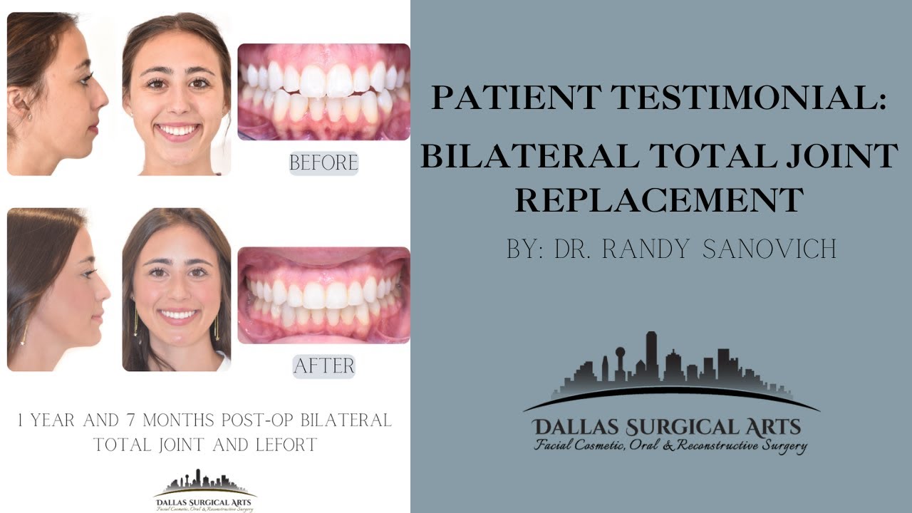 Patient Testimonial: TMJ Total Joint Replacement with Dr. Randy ...