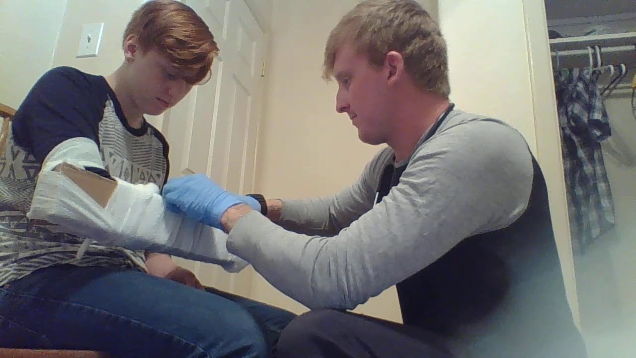 Splinting Skill Video - YouTube