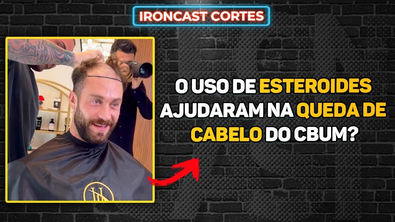 CBUM FEZ UM TRANSPLANTE CAPILAR E MUDA O VISUAL– IRONCAST CORTES - YouTube