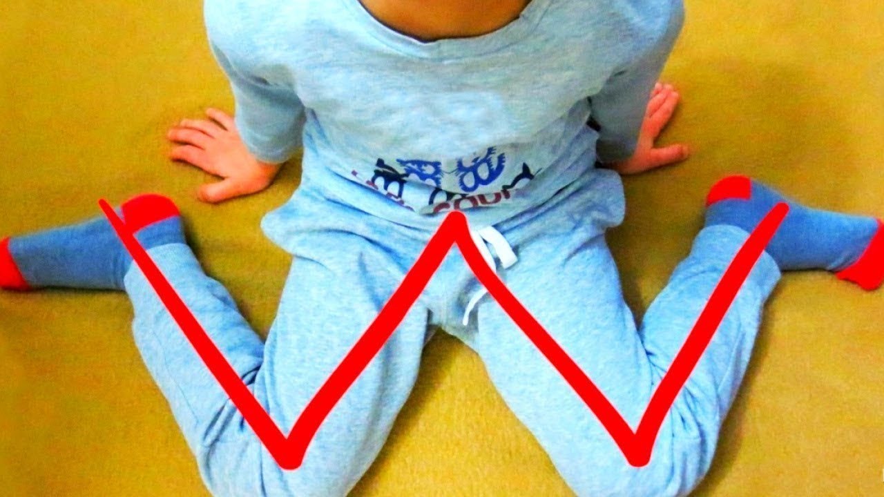 Never Let Your Kids Sit in the “W” Position Here's Why! - YouTube