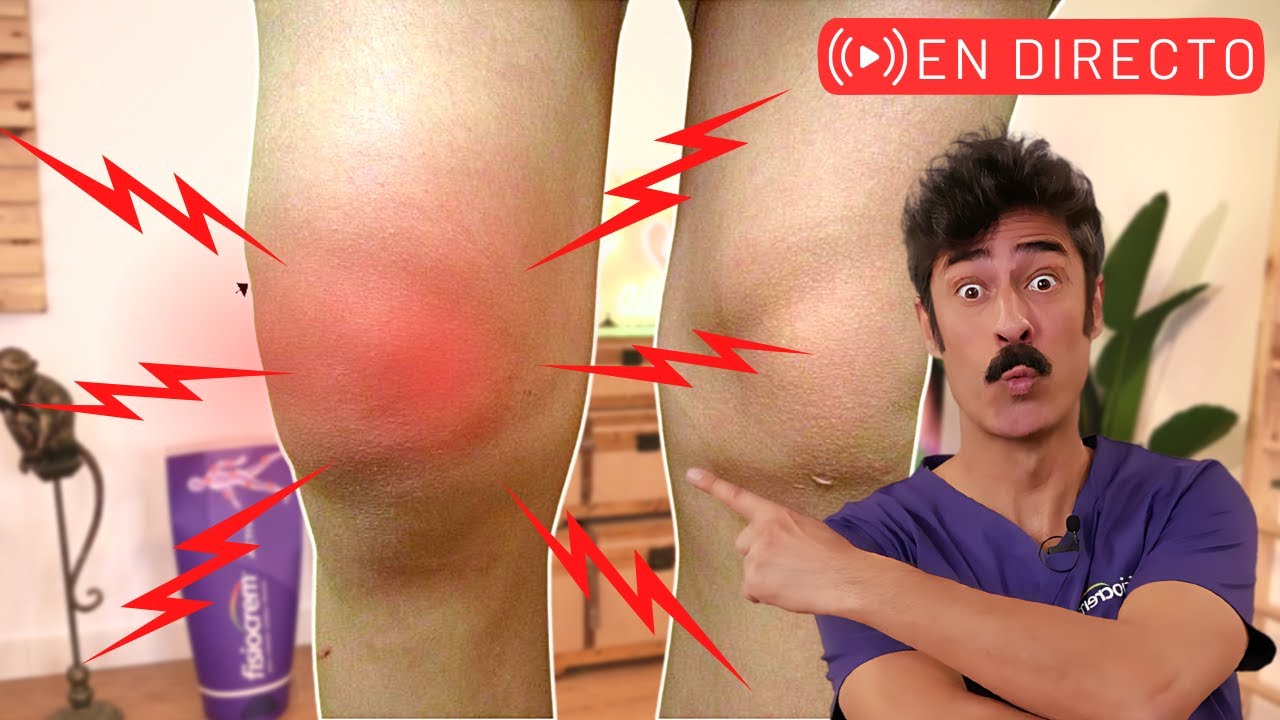 🔴 No más DOLOR de RODILLA! NO puedes flexionar ? Ejercicios para ...