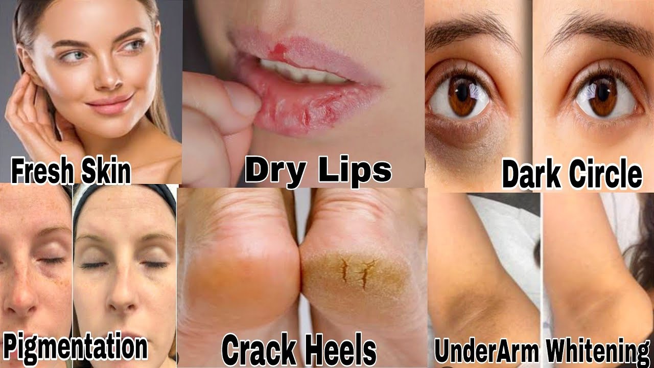 Very Important Wali Skincare - No Dry lips, Underarm Darkness, Crack ...
