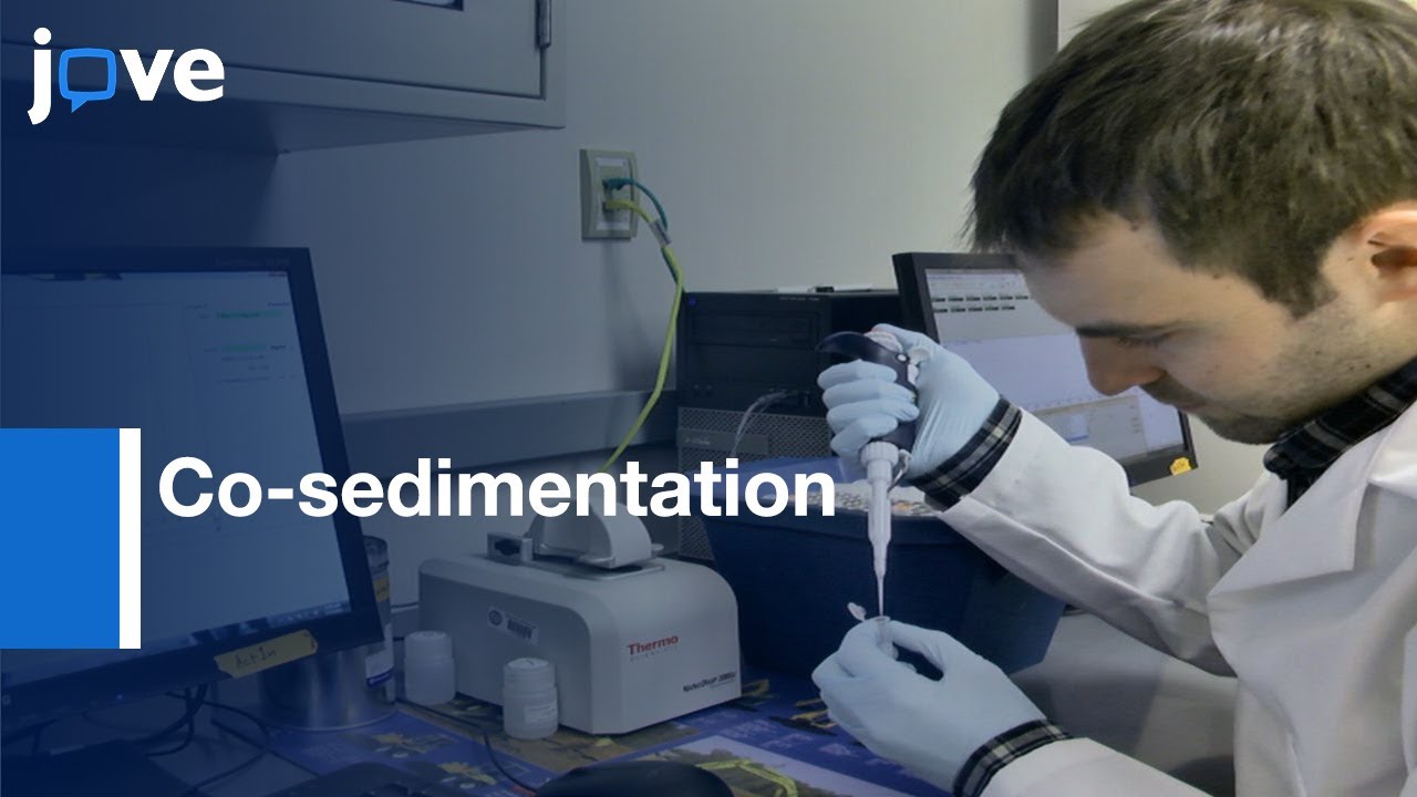 Protein Binding to F-actin Measurement by Co-sedimentation | Protocol ...