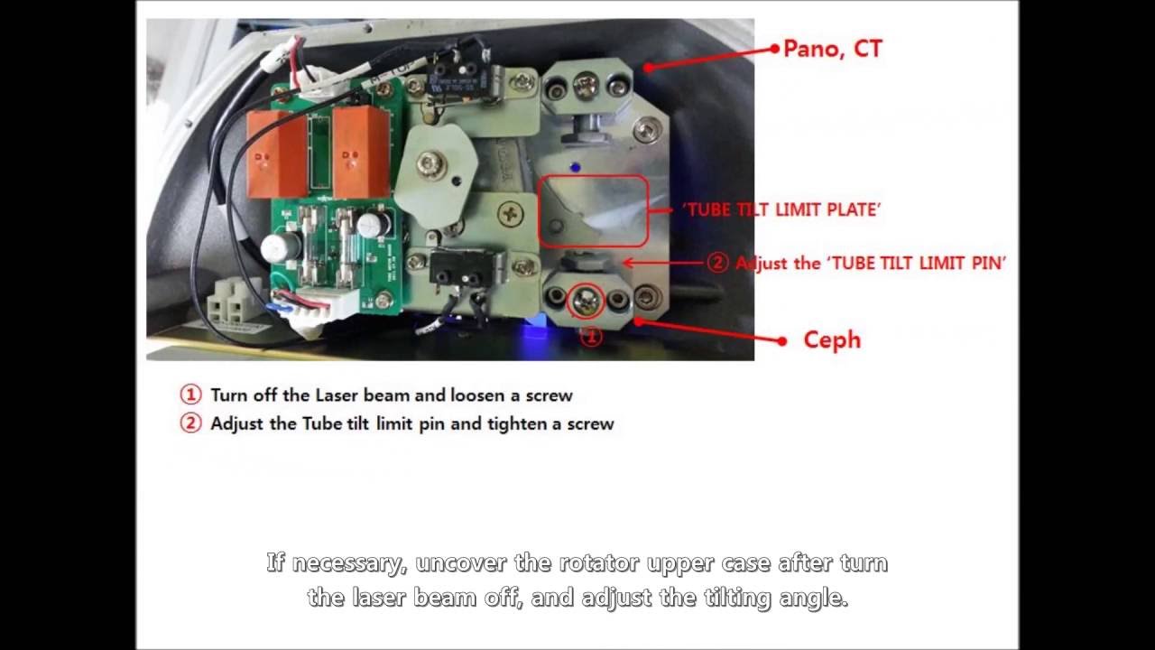 Scan ceph Alignment tutorial on RAYCAN Alpha - YouTube