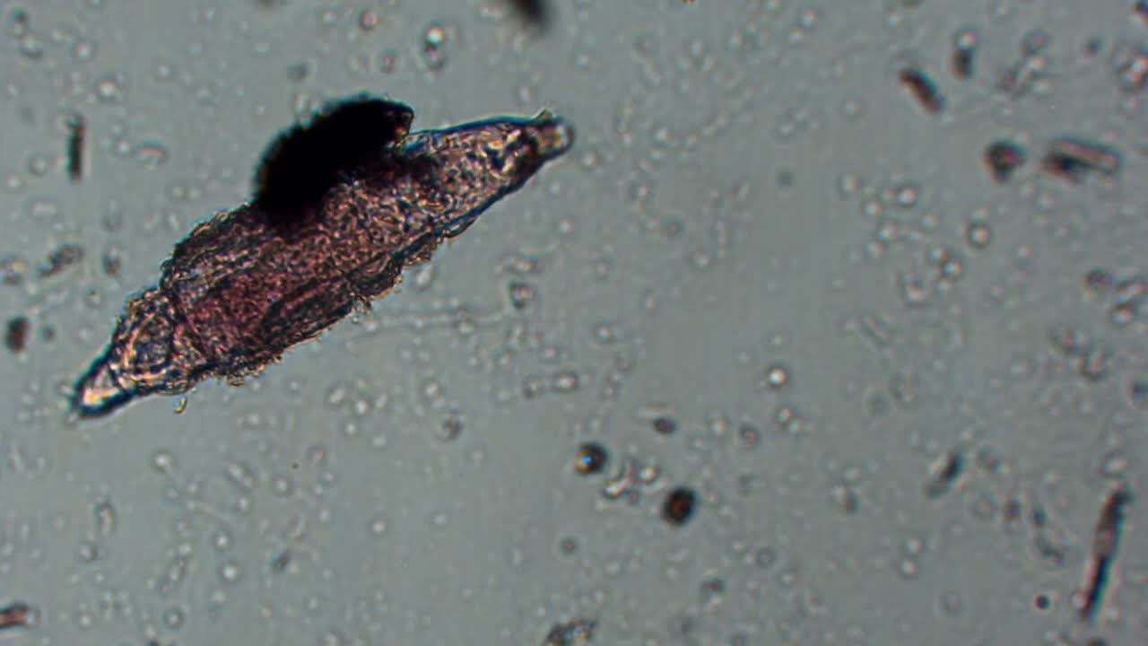 Rotifer Microorganism Under My AmScope Microscope - Rotifer Moving ...
