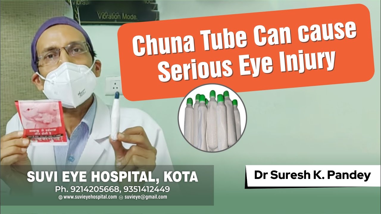 Chuna Tube Can cause Serious Eye Injury Dr Suresh K Pandey SuVi Eye ...