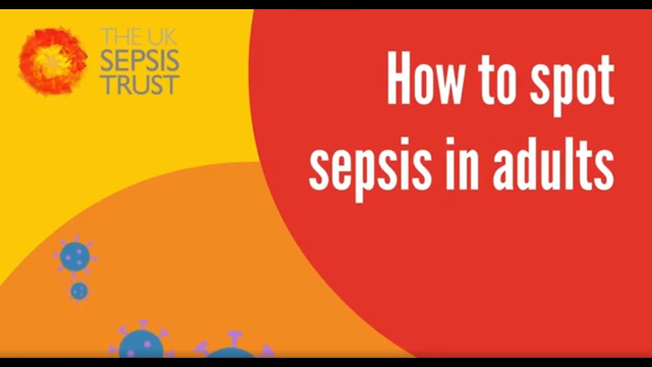 How to spot sepsis in adults - YouTube