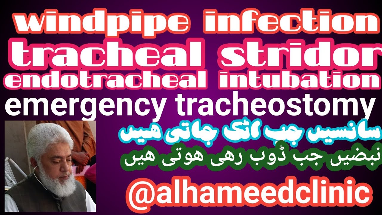 WHAT IS TRACHEITIS . WHAT IS TRACHEAL STRIDOR . WHAT IS TRACHEAL WHOOP ...
