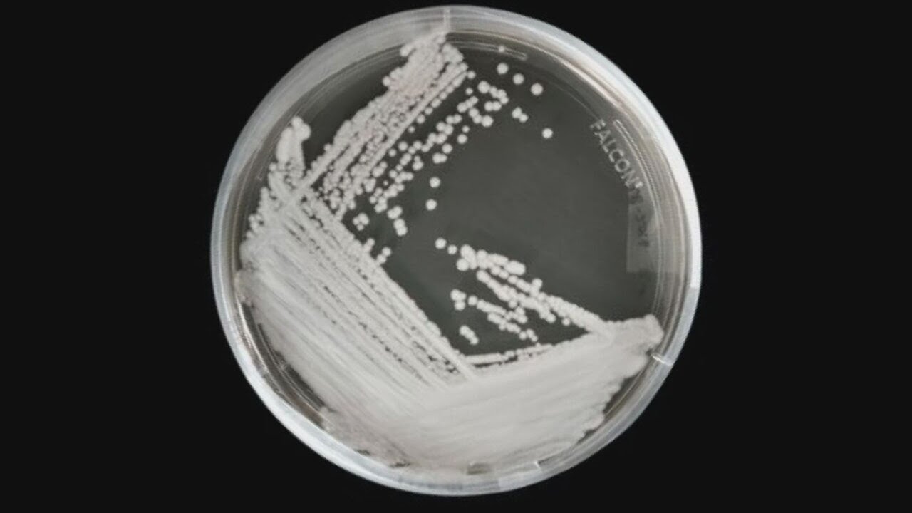 UNLV researchers find deadly fungus in wastewater across Las Vegas ...