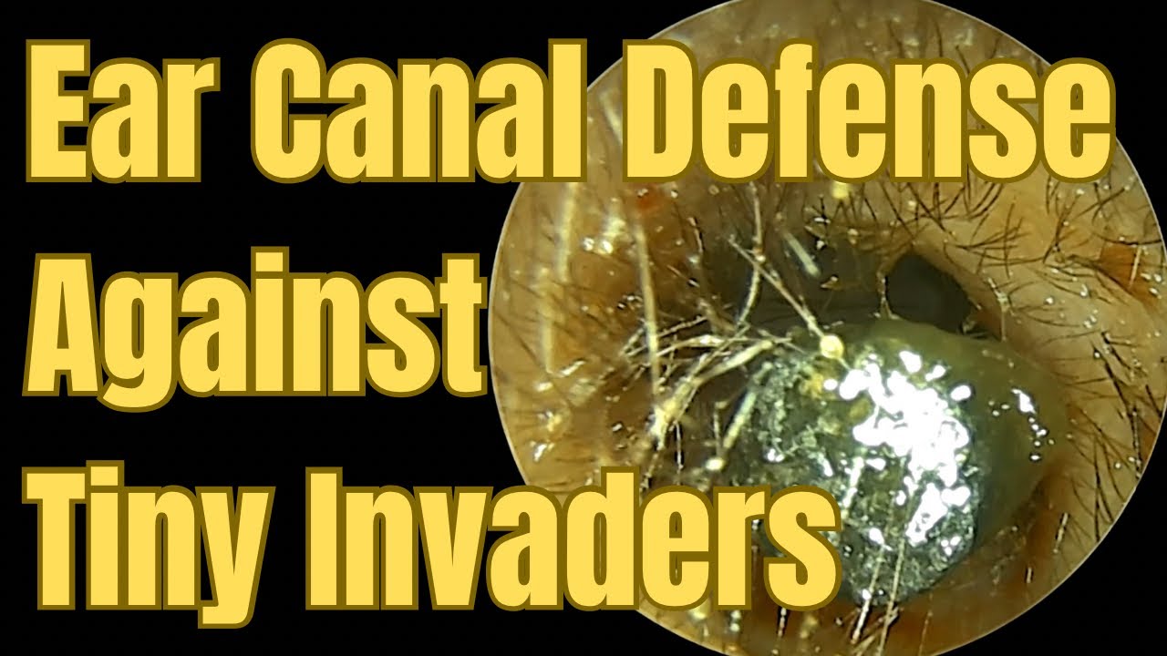 Ear Canal Defense Against Tiny Invaders - YouTube