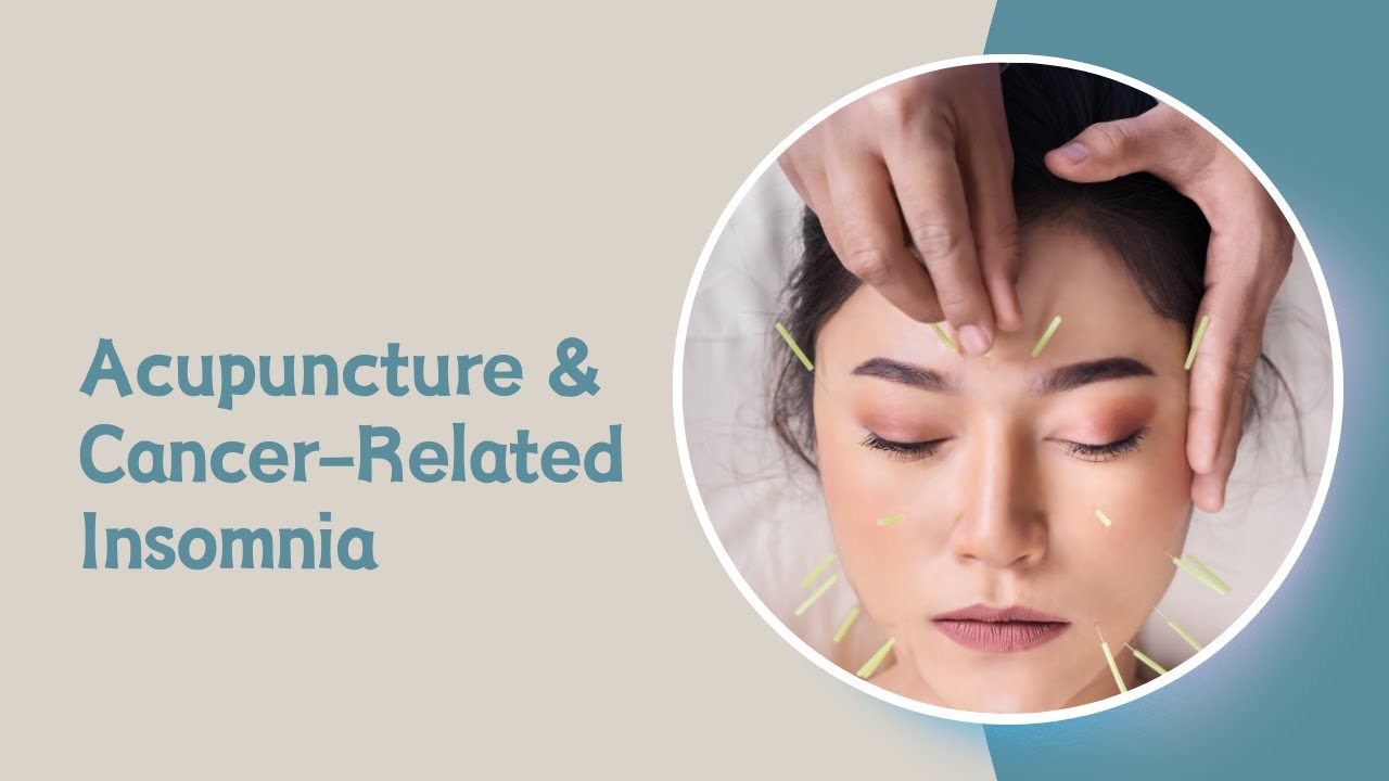 Acupuncture for Cancer-Related Insomnia - YouTube