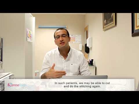 Estetik Operasyon ile Sezaryen Yara İzleri Nasıl Geçirilir?