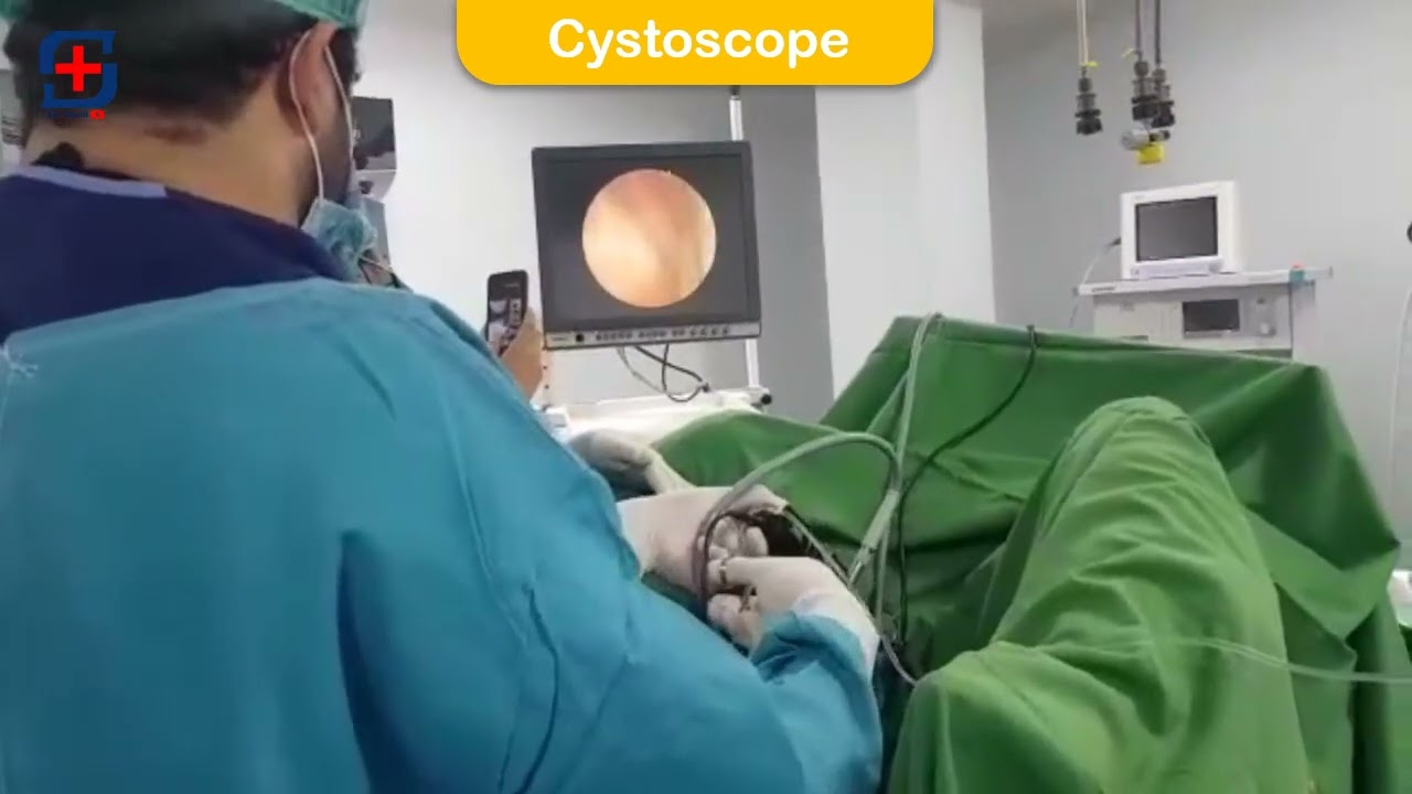 Cystoscope - YouTube