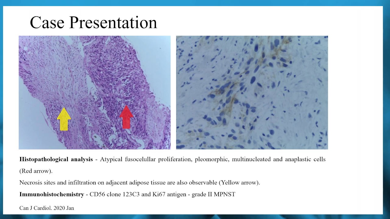 May 2020 S. America Monthly Case Review Webinar - YouTube