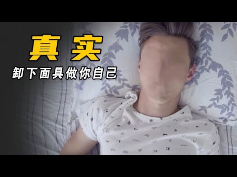 男孩天生没有脸，只能靠戴上面具生活 - YouTube