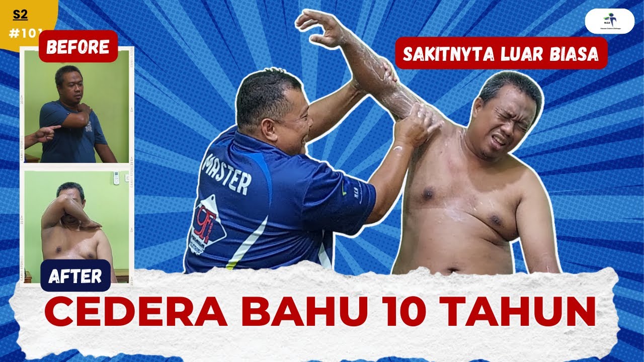 CEDERA BAHU SUDAH 10 TAHUN PASIEN ASAL KENDAL - YouTube