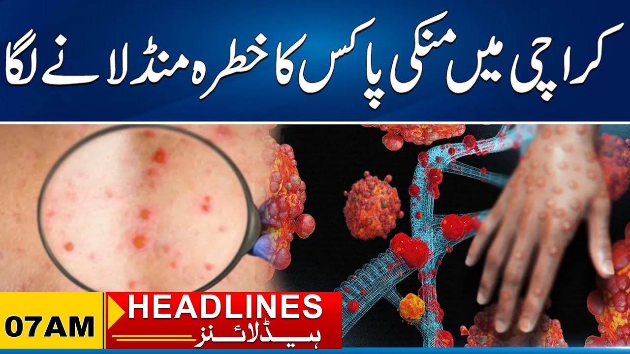 Threat Of Monkey Pox In Karachi | 7 am News Headlines I 24 Mar 2025 I ...