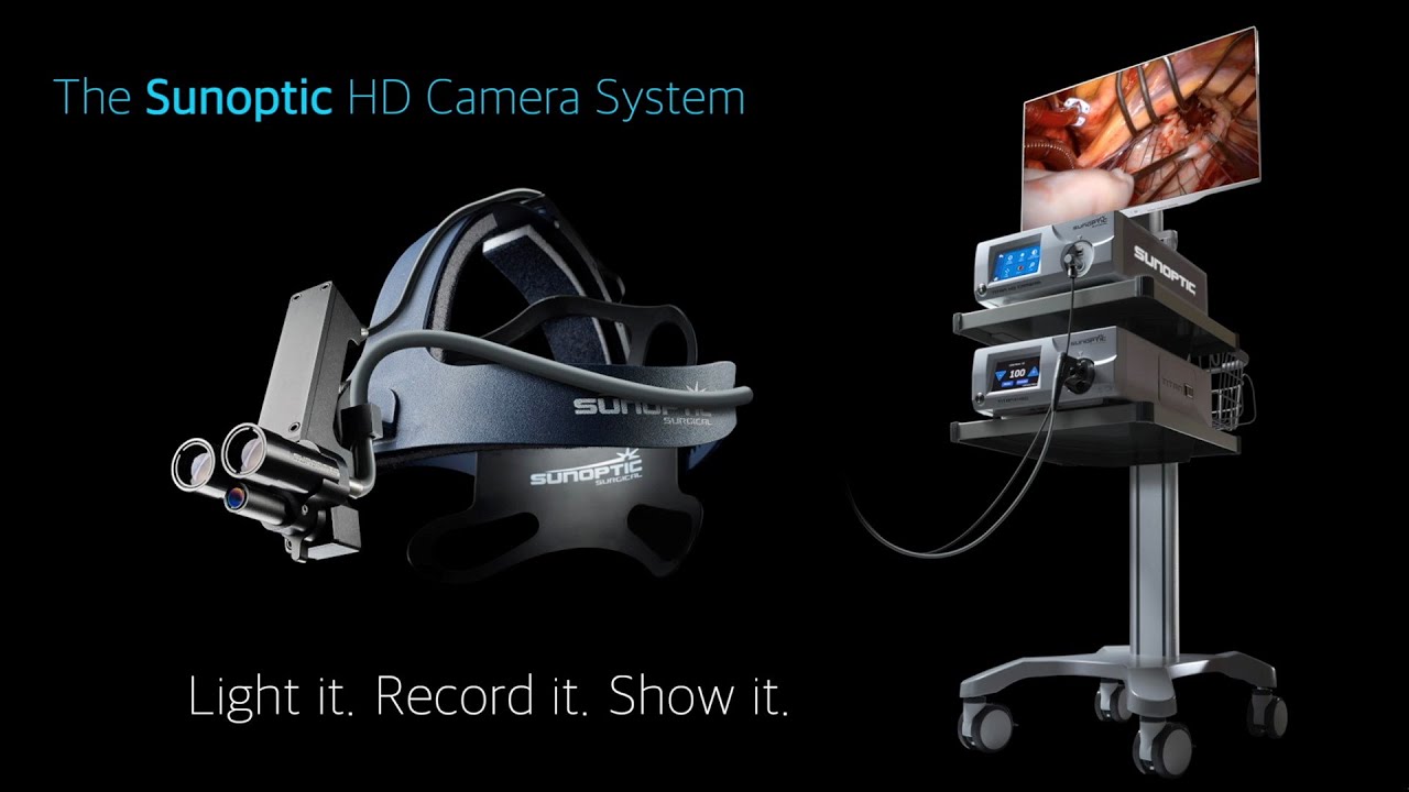 Sunoptic HD Surgical Headlight Camera Product Video - YouTube