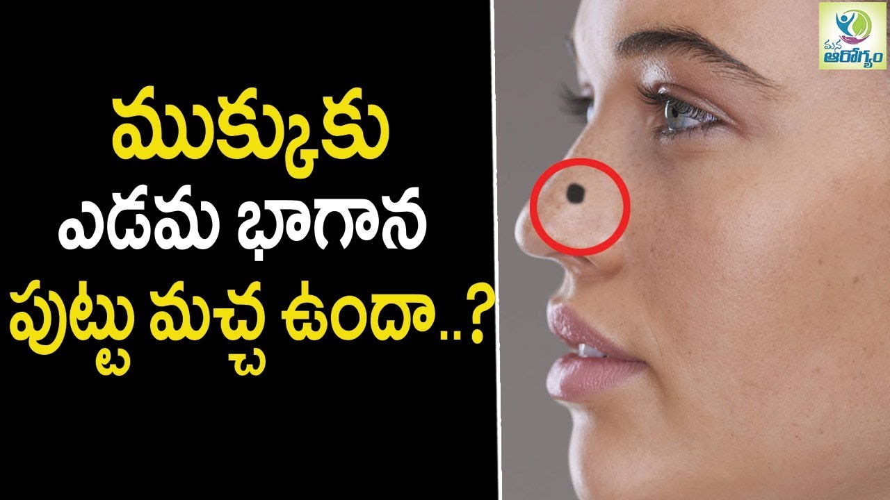 Meaning Of Moles On Nose Health Tips In Telugu Mana Arogyam YouTube meaning-of-moles-on-nose-health-tips-in-telugu-mana-arogyam-youtube