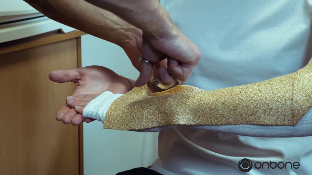 6 Above Elbow - YouTube