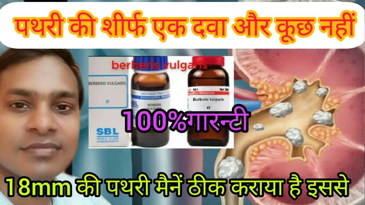 Pathri Ka ilaj ,Pathri ki dawa,berberis vulgrish Best Homeopathic ...