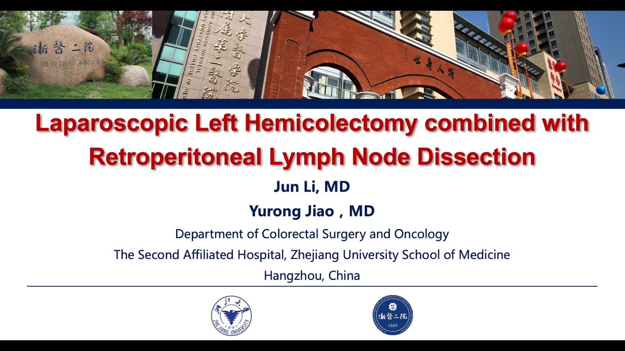 Laparoscopic Left Hemicolectomy combined with Retroperitoneal Lymph ...