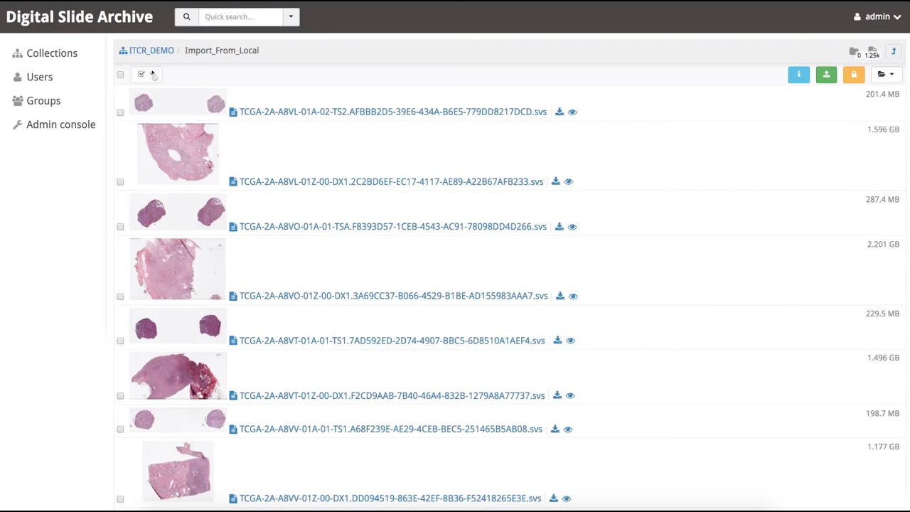 Managing and visualizing data with the Digital Slide Archive - YouTube
