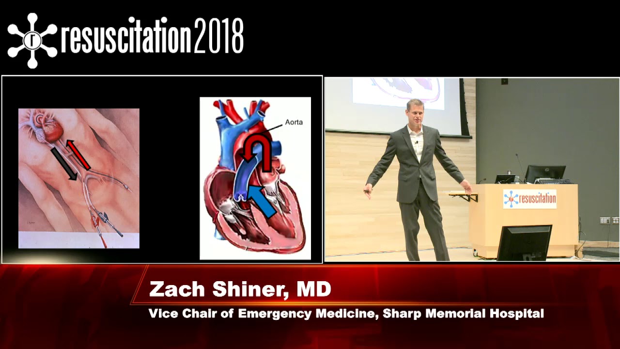 Making ECPR a Reality in Your ED - Zach Shinar, MD. - Resuscitation ...