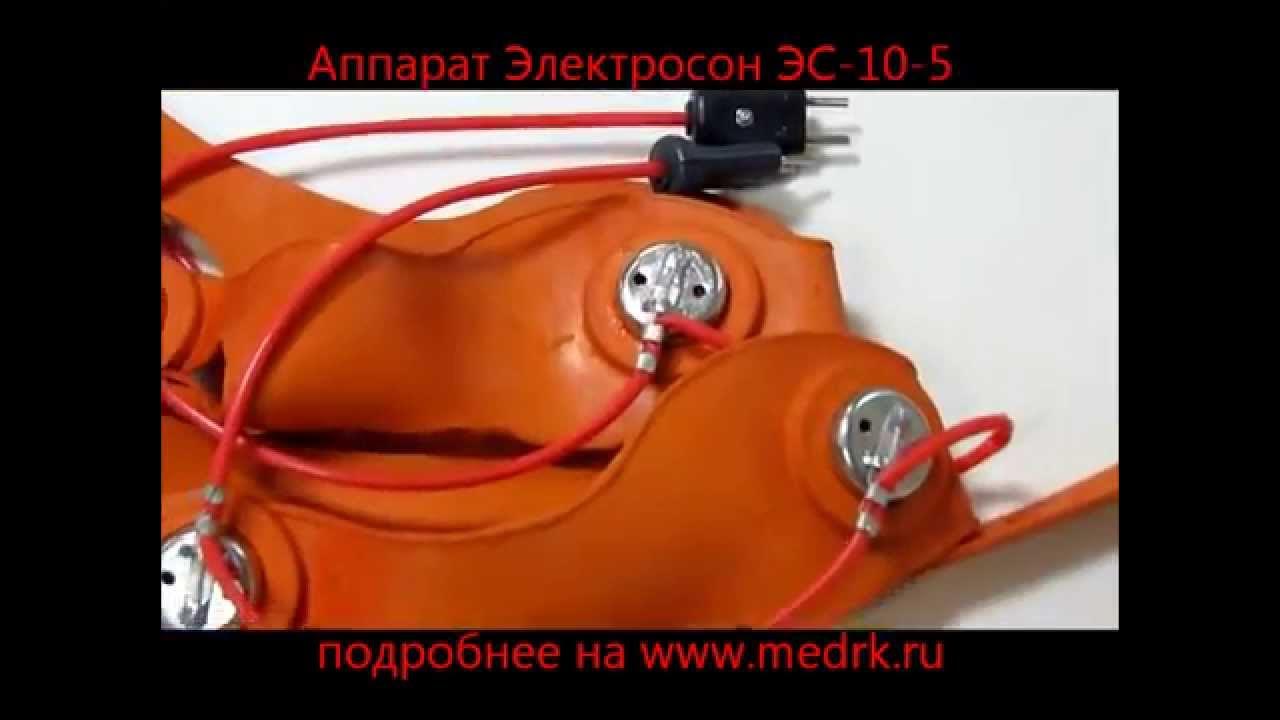 Аппарат Электросон ЭС-10-5 - YouTube