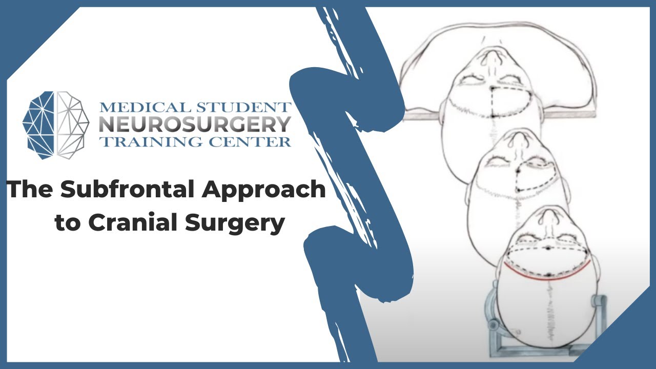 The Subfrontal Approach to Cranial Surgery - YouTube
