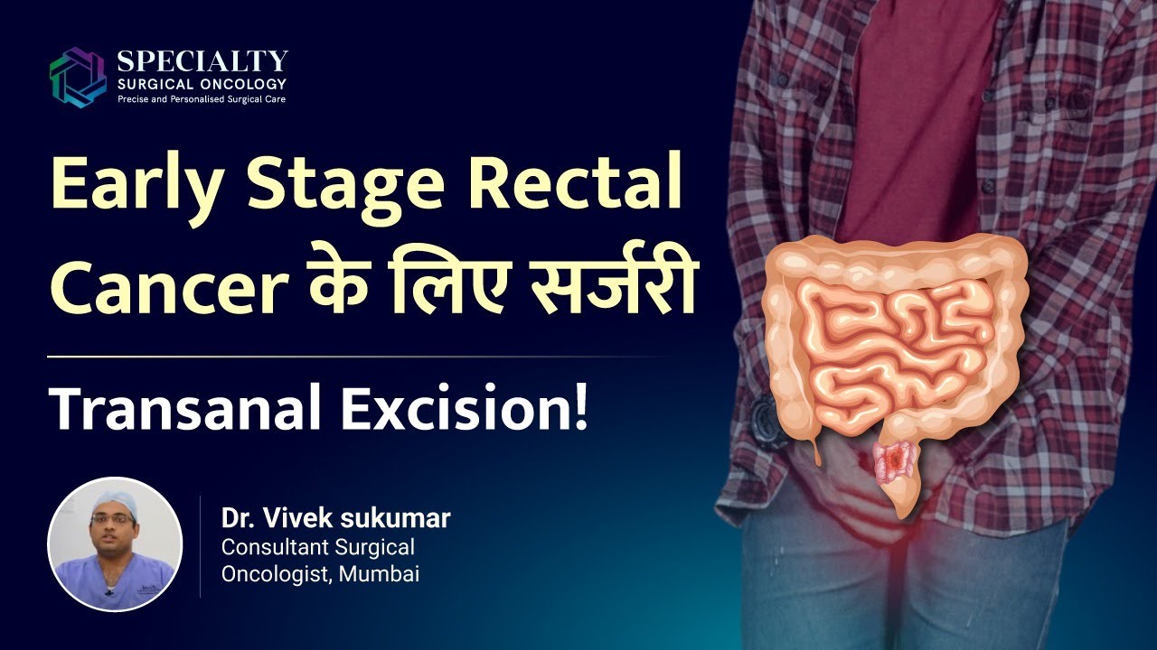 Rectal cancer के लिए सर्जरी | Transanal Excision: A Minimally Invasive ...