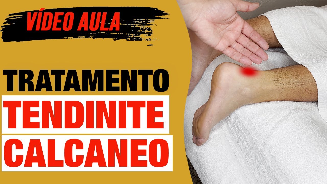 Tendinite do Tendão do Calcâneo - Vídeo Aula - YouTube