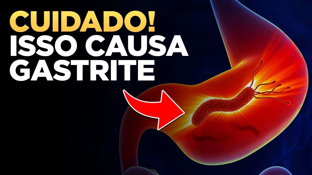 O MELHOR MÉTODO PARA ACABAR com a GASTRITE, REFLUXO GÁSTRICO, ESTÔMAGO ...