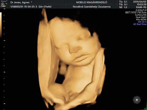 4D ultrahang babamozi 25 - 32 hetes - YouTube