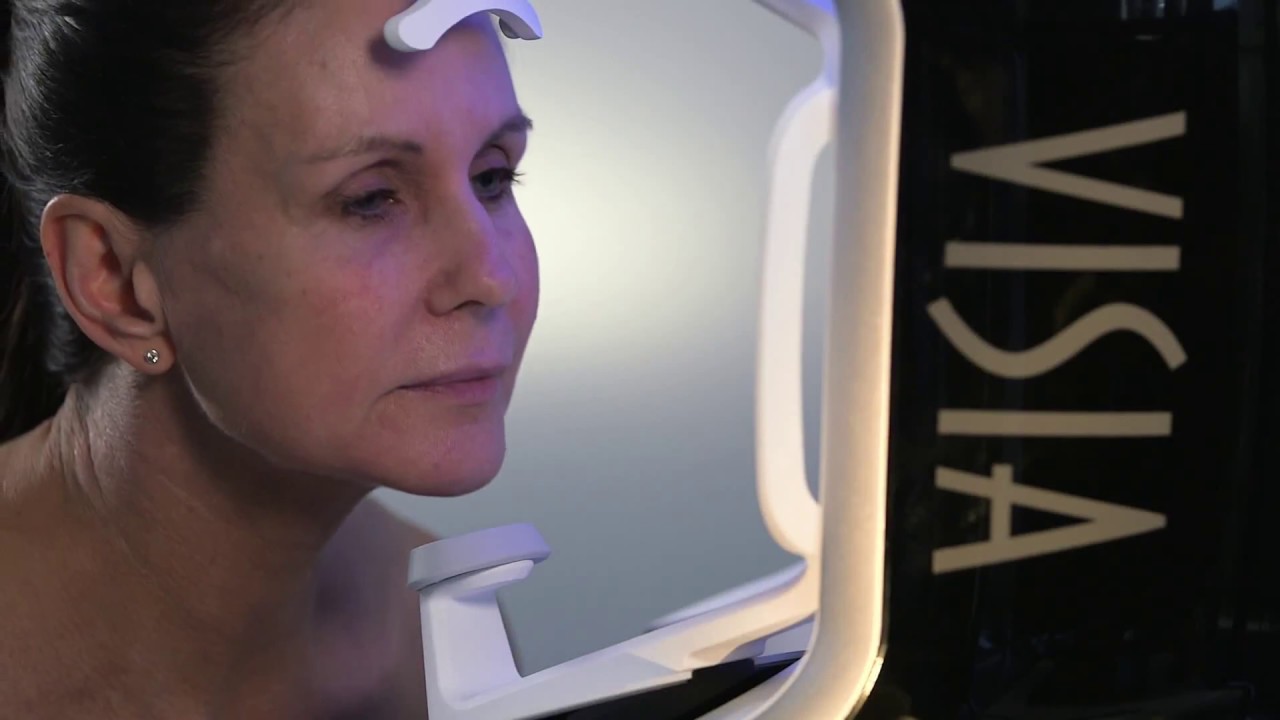 Visia Scan Tests MicrodermMD's Impacts After Just 30 Days - YouTube