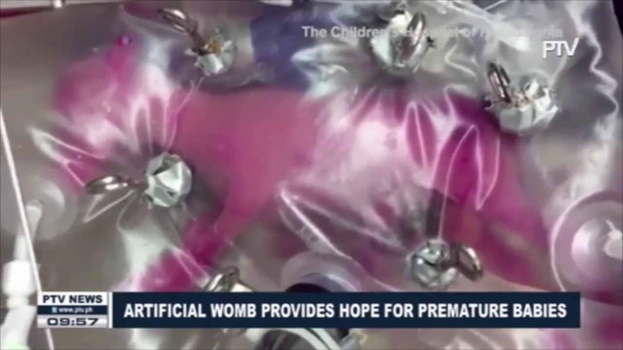 Artificial womb provides hope for premature babies - YouTube