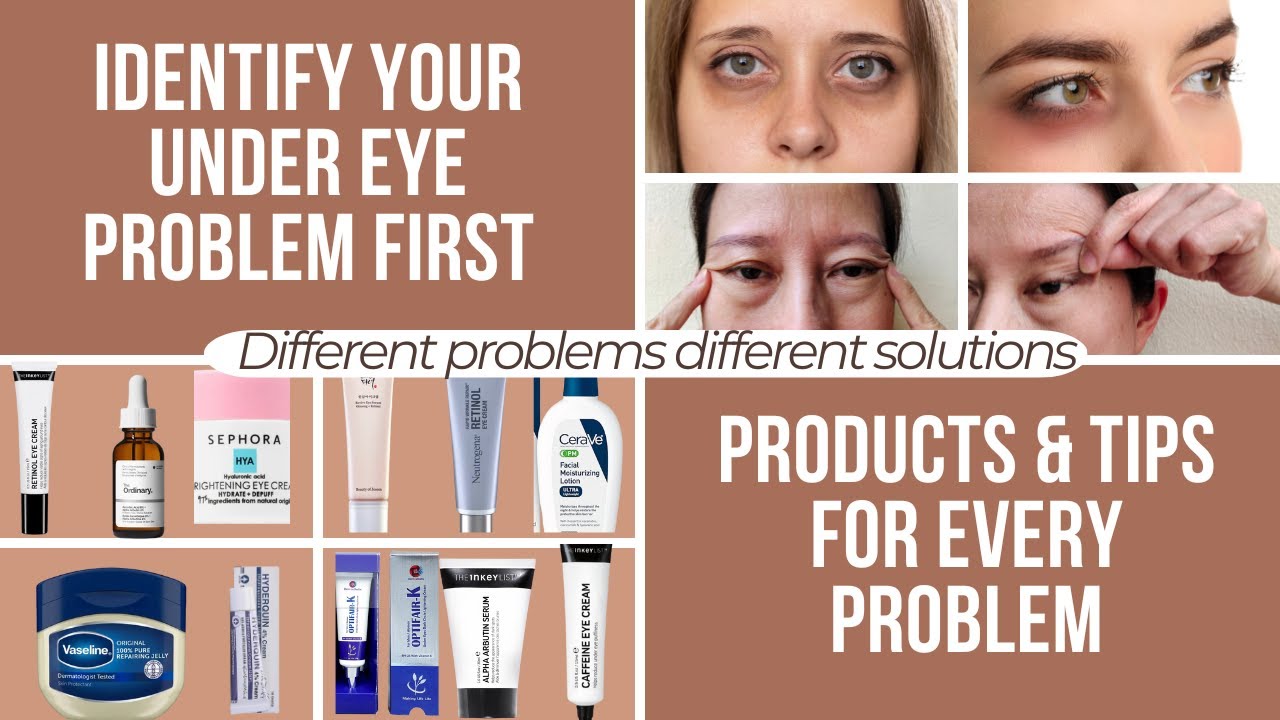 Types of Under Eye Problems and Solutions, How to differentiate and ...