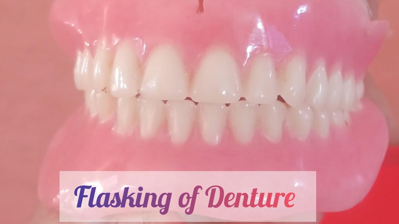 Flasking of Denture #work #video - YouTube