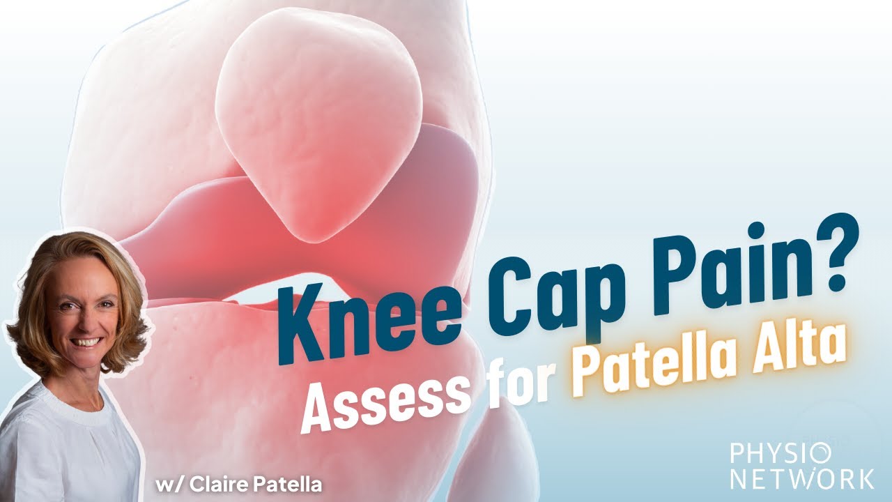 Assessing for a high patella for Knee Cap (Patellofemoral) Pain - YouTube