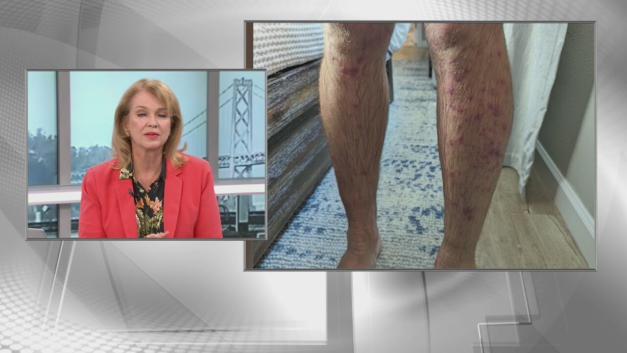 Hundreds say they developed rashes at Tough Mudder - YouTube