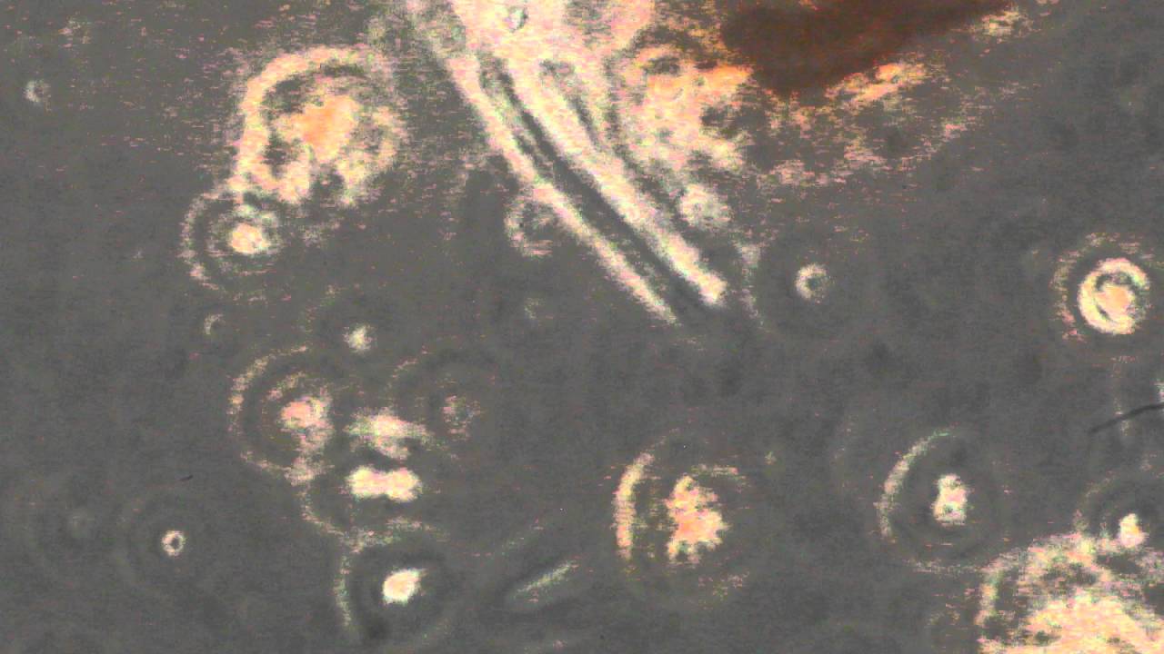 KIS Organics Biochar Soil + Molasses 28 hrs under the microscope - YouTube