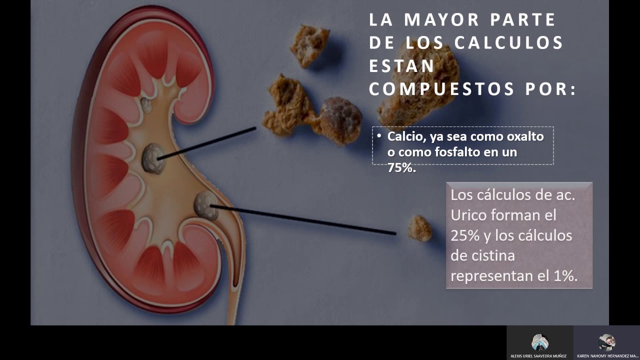 Urolitiasis/Pia - YouTube