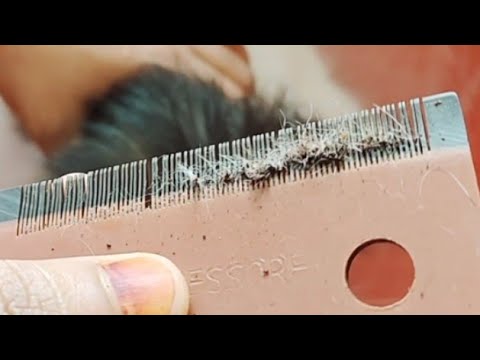 flea removal part 🐈3 - YouTube