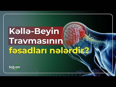 Kəllə-Beyin Travmasının fəsadları nələrdir?