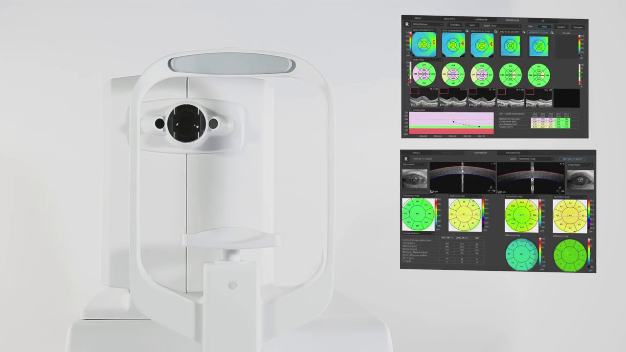 OCT REVO 60 Optopol Tecnology - YouTube