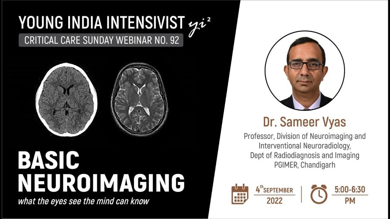 BASIC NEUROIMAGING : PROF SAMEER VYAS ( NEURORADIOLOGY PGI CHD) - YouTube