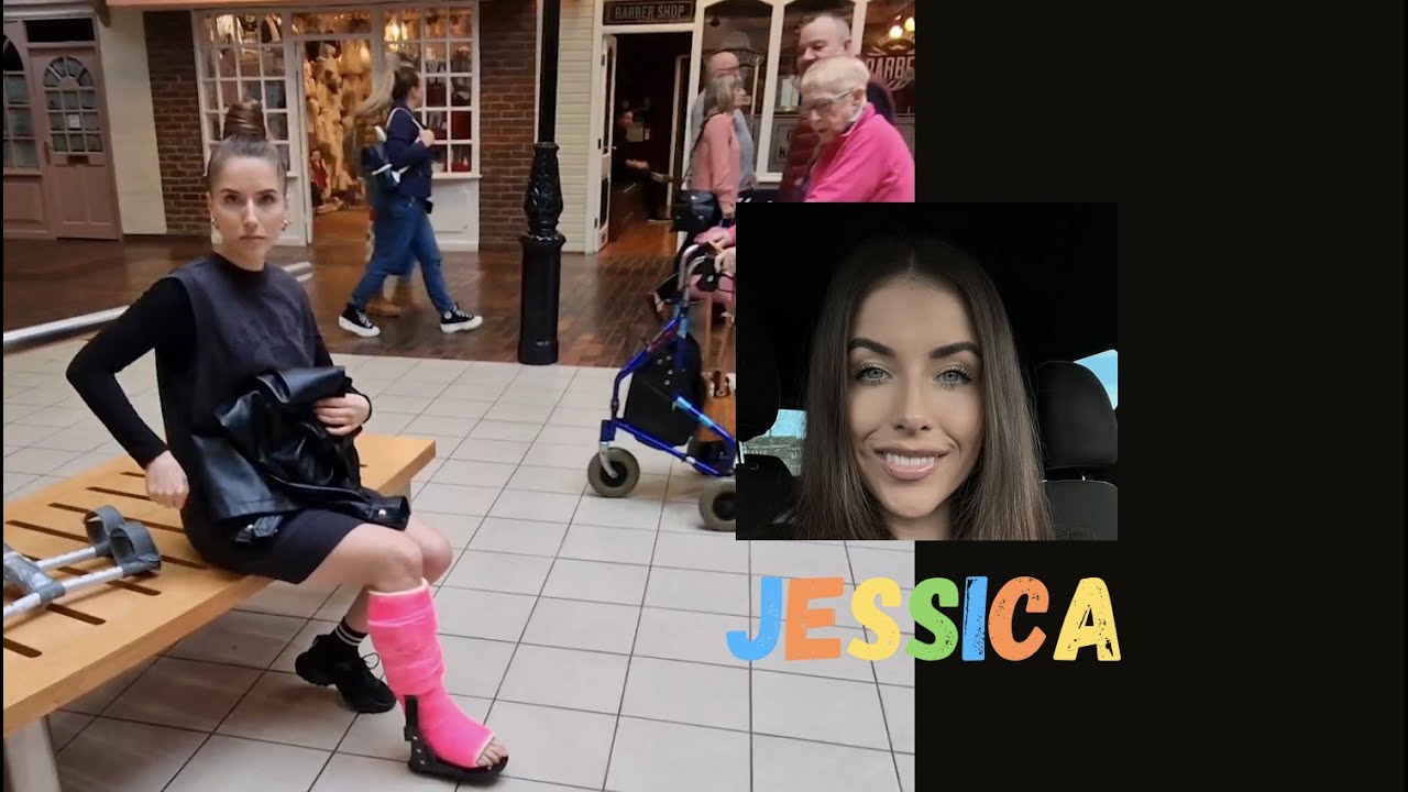 Short Leg Walking Cast - YouTube